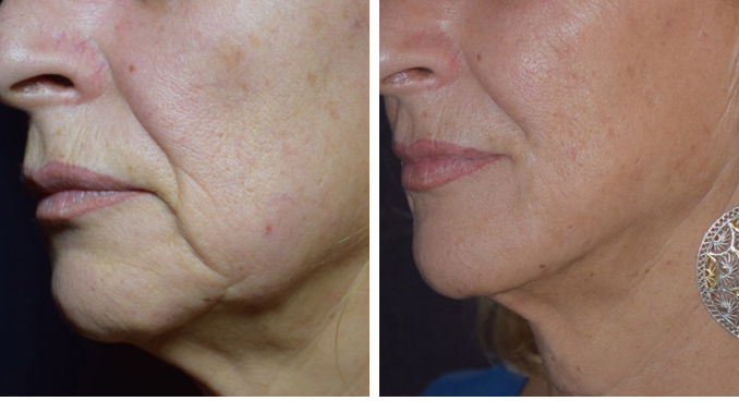Facetite - Fante Eye and Face Centre
