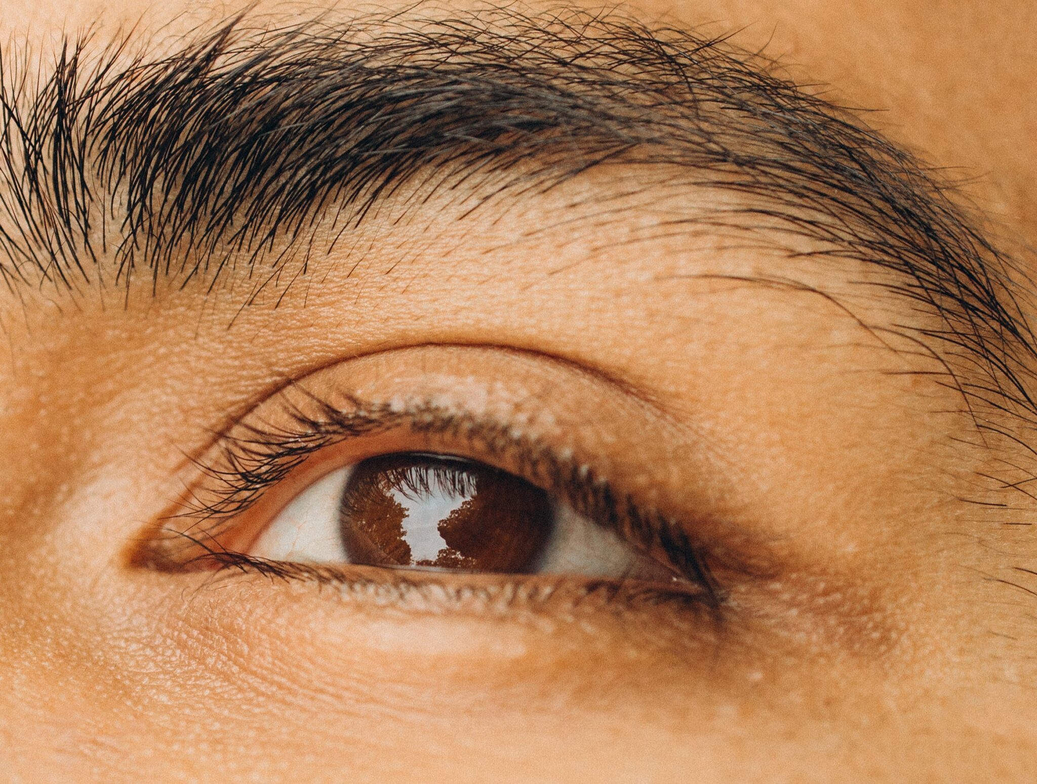 How to Correct Eyelid Retraction: Effective Solutions